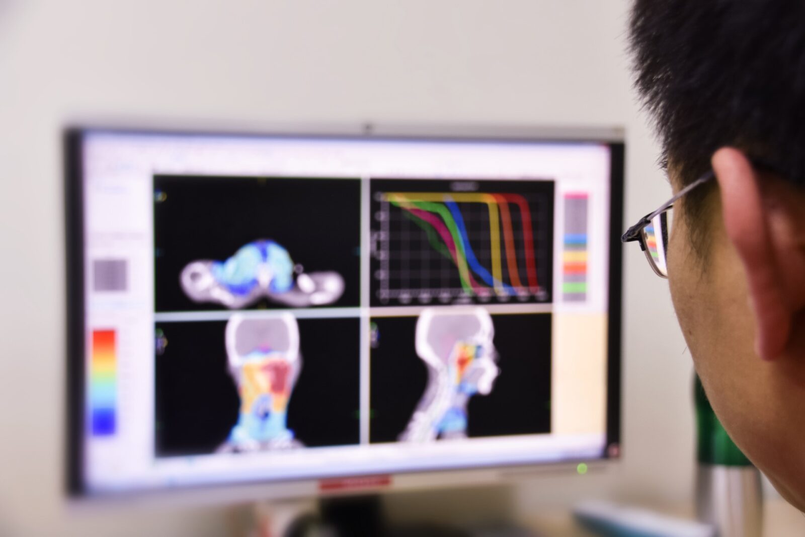 Soft Tissue Radionecrosis | Hyperbaric Oxygen Treatment | Oxygen Oasis