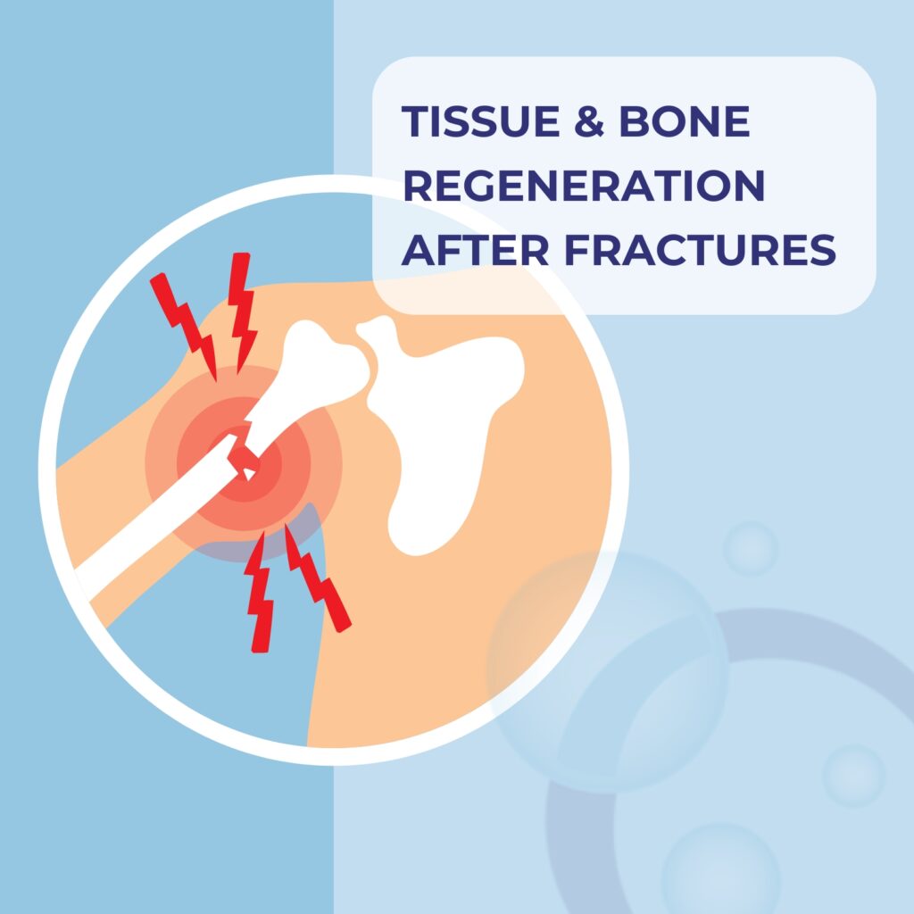Accelerating Recovery: The Role of Hyperbaric Oxygen Therapy in Tissue ...