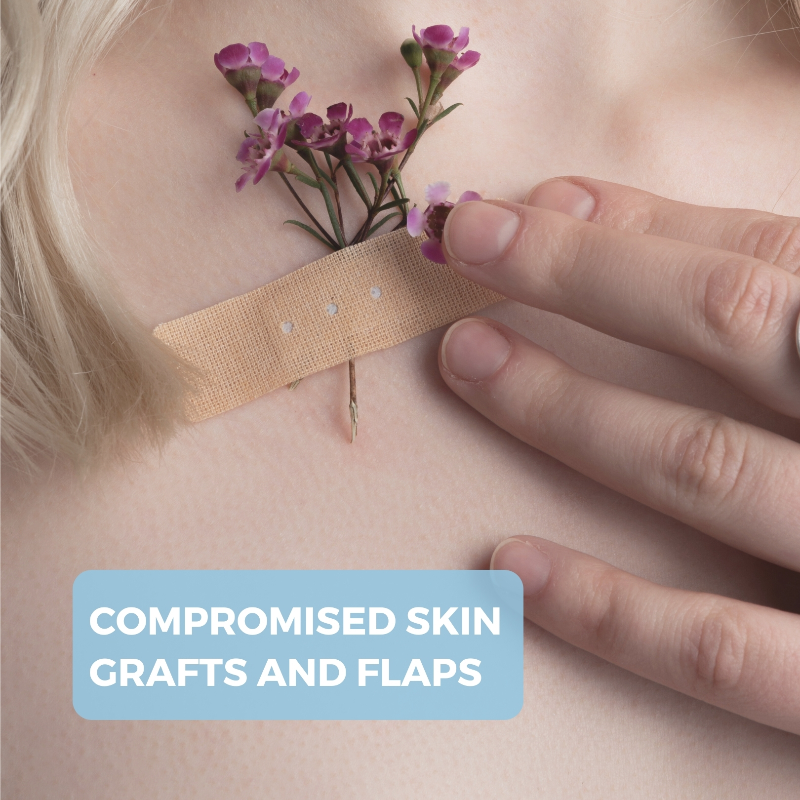 The Role of Hyperbaric Oxygen Therapy in Saving Compromised Skin Grafts ...